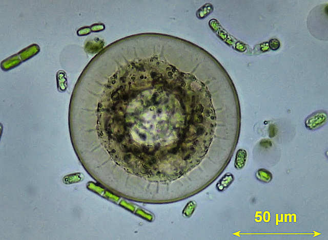 Pond life photomicrographs: Protozoa