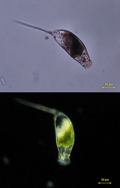 Pond life photomicrographs: Rotifers